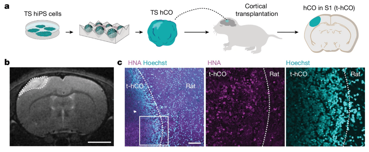 From Lab to Life: New Organoid Insights and Genetic Therapeutics for ...